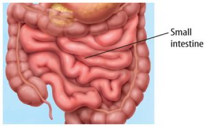 Dr. Harshad Mahatme : Surgery For Small Intestine